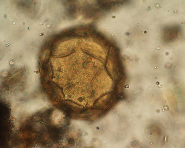 Protozoa | Field Guide | Llano River Field Station | Center at Junction ...