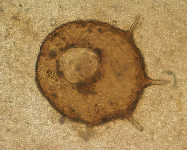 Protozoa | Field Guide | Llano River Field Station | Center at Junction ...