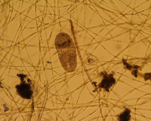 Protozoa | Field Guide | Llano River Field Station | Center at Junction ...