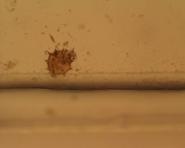 Protozoa | Field Guide | Llano River Field Station | Center at Junction ...