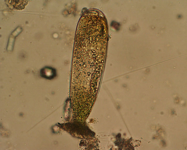 Protozoa | Field Guide | Llano River Field Station | Center at Junction ...